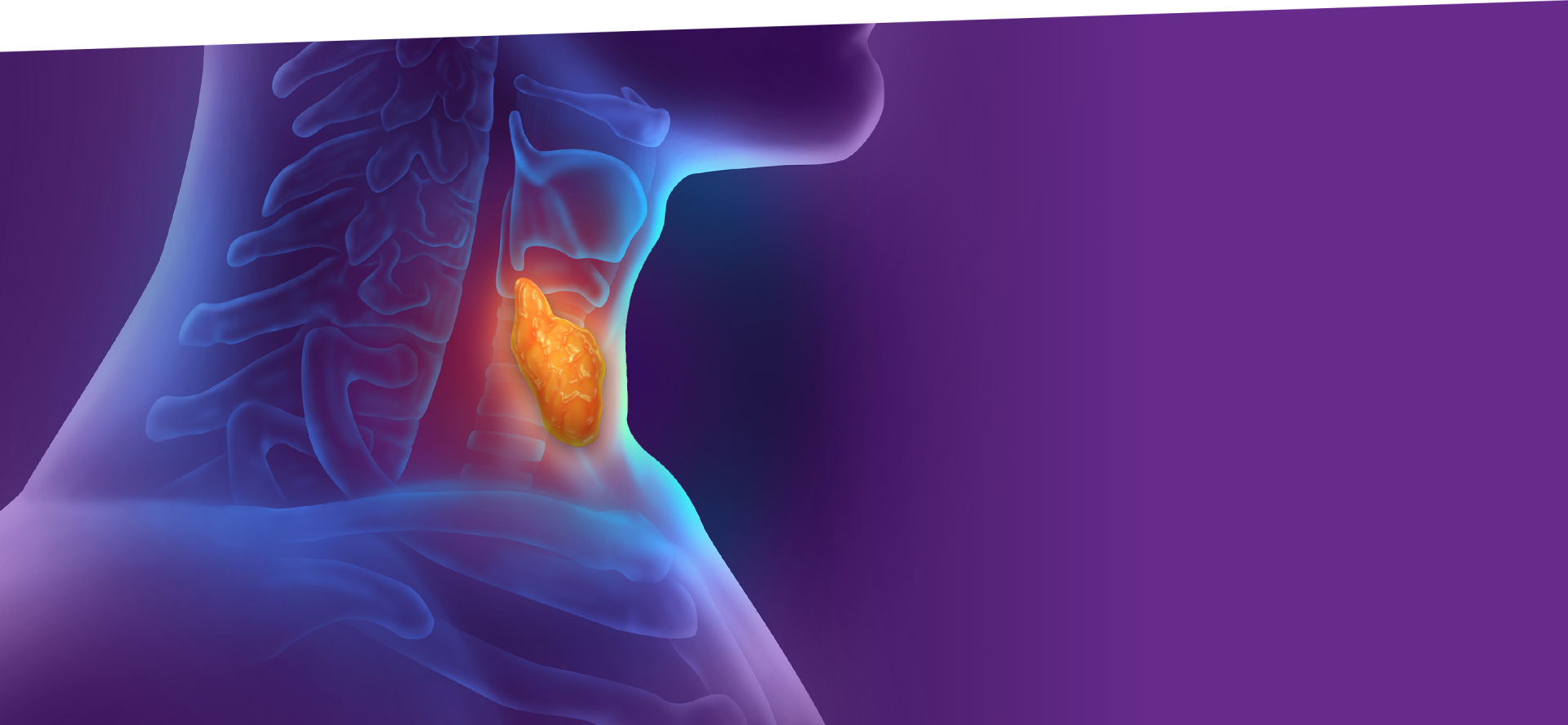 Afirma® Genomic Test for Thyroid Nodules