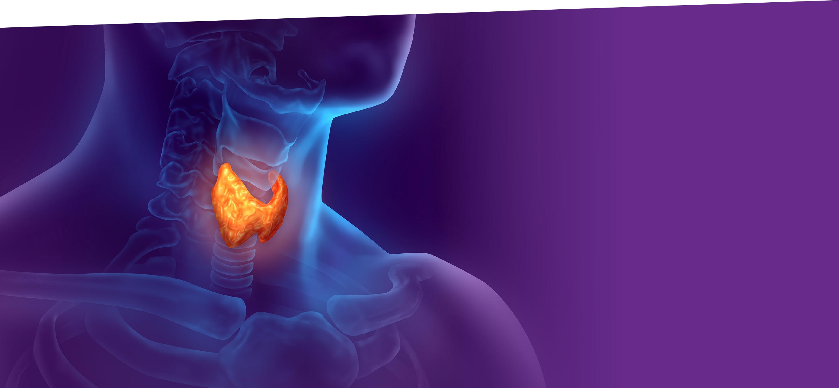 Afirma® Genomic Test for Thyroid Nodules