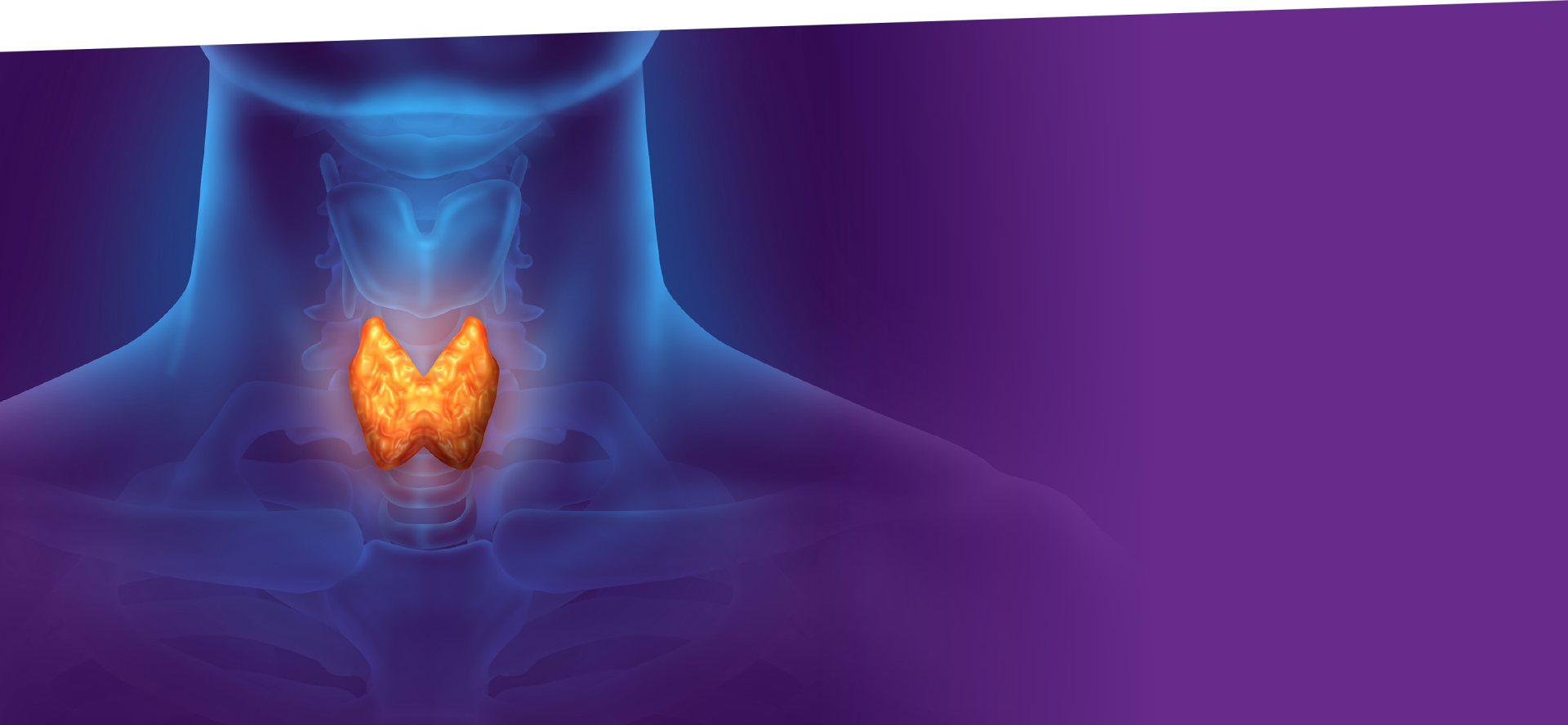 Afirma® Genomic Test for Thyroid Nodules